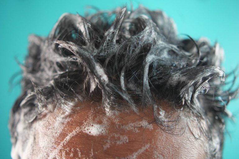 Why Dandruff is Severe in Winter or Cold Season?